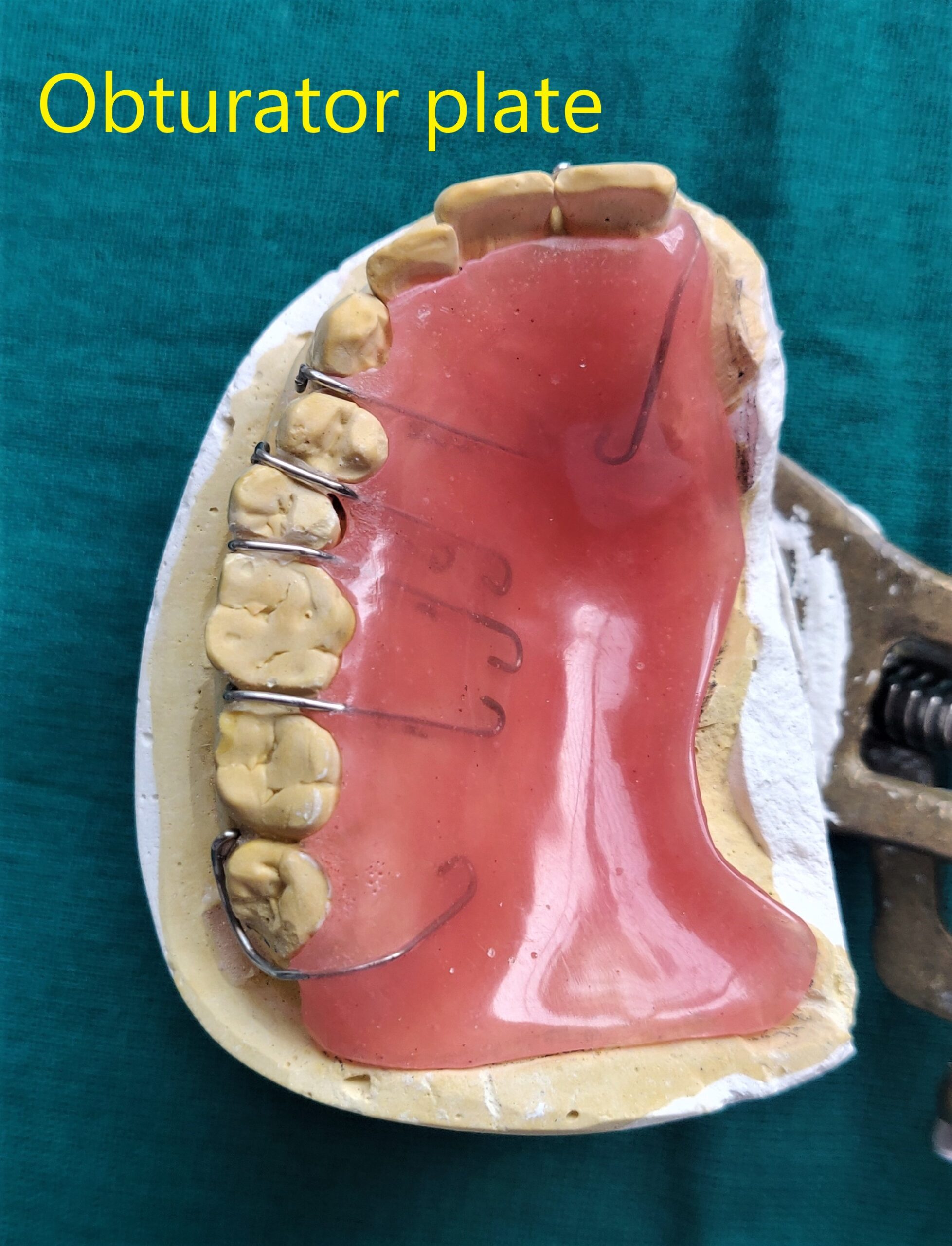 Expert Maxillofacial Prosthetics at AuraDent